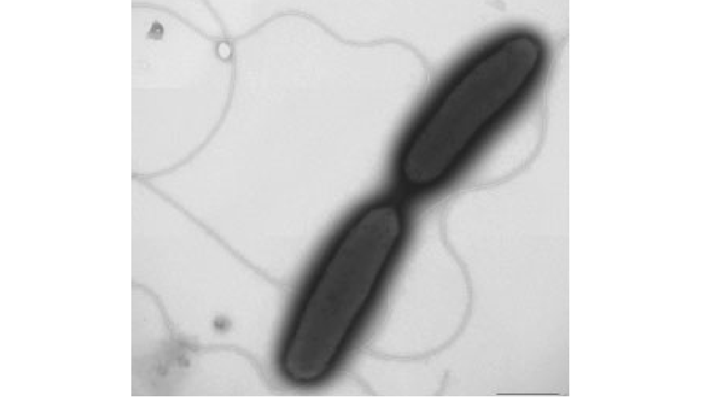 Analysis of microbiota of indigo fermentation and its function ...